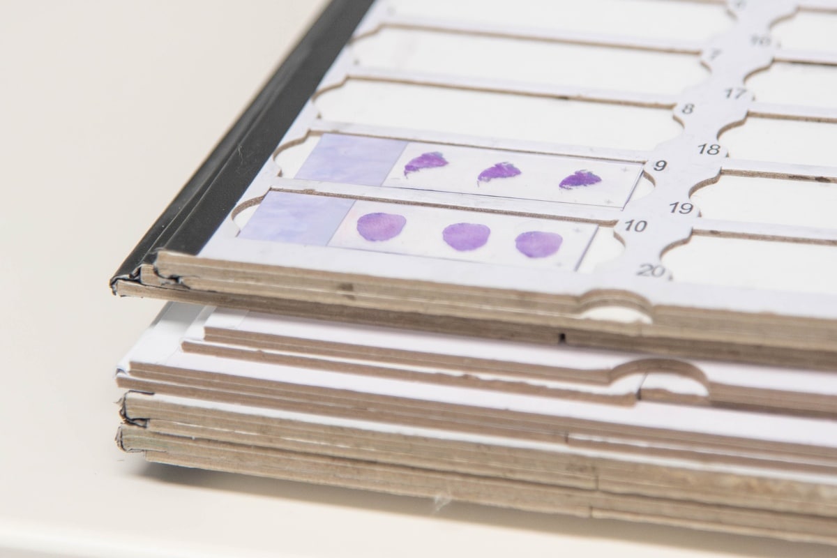 Comprehensive Allergy Testing at Chang Dermatology | VB