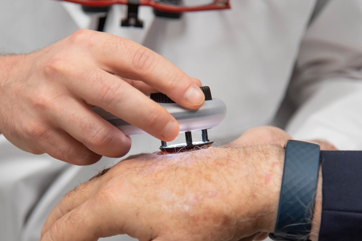 Skin Cancer Detection and Treatment at Chang Dermatology